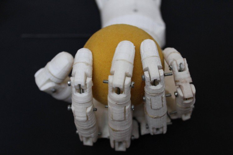 Bionic Arm Moved Vith Voice